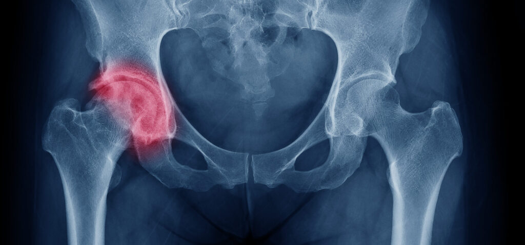 Professor Ali Ghoz - Professor Ali Ghoz