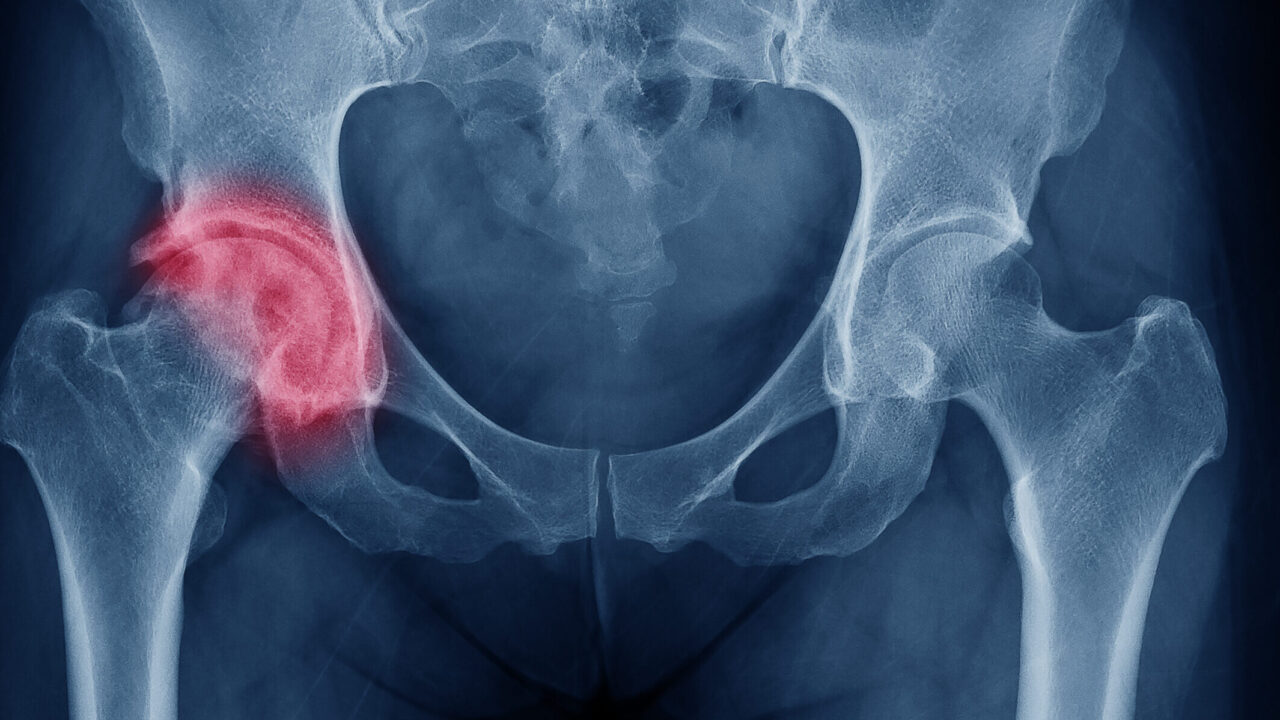 Professor Ali Ghoz - Professor Ali Ghoz