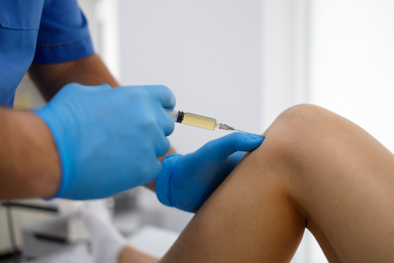 Arthrosamid vs Steroids, PRP & Hyaluronic Acid: Which Is Right for You ...